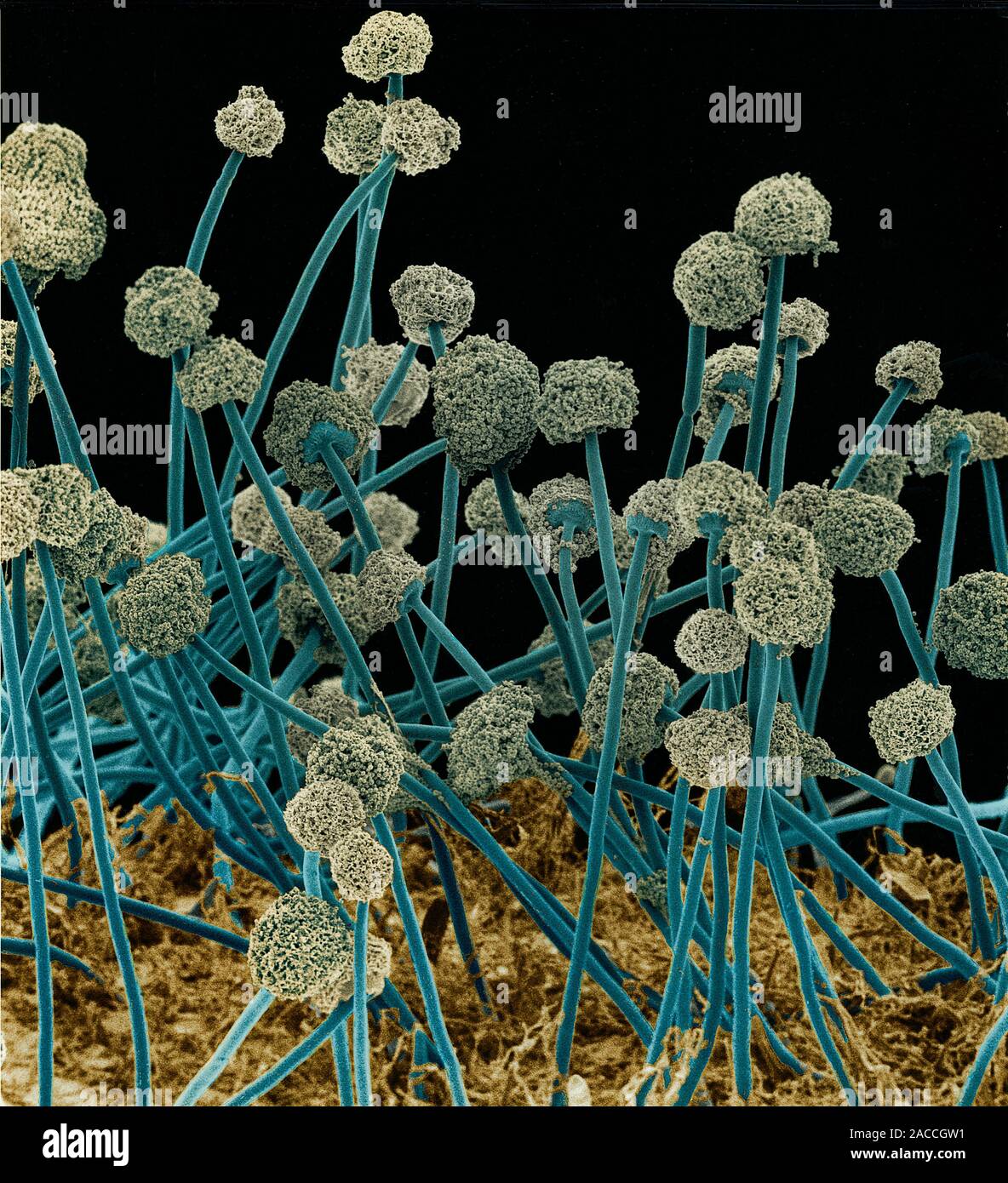 False colour scanning electron micrograph (SEM) of the spore-bearing ...