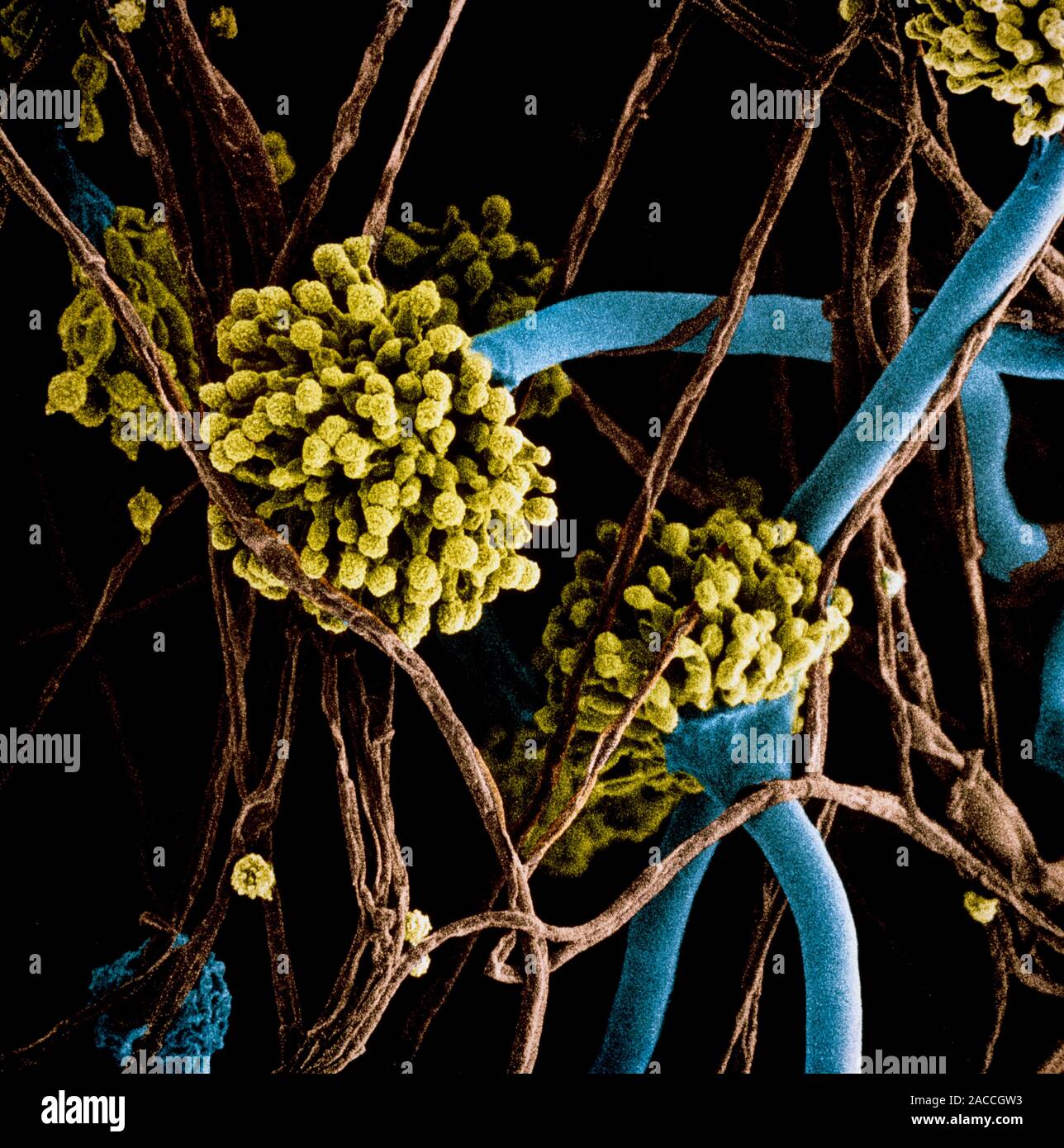 False colour scanning electron micrograph (SEM) of the spore-bearing ...