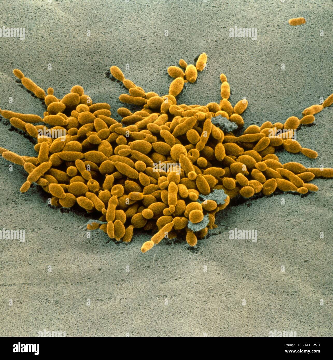 False-colour scanning electron micrograph of an unidentified yeast ...