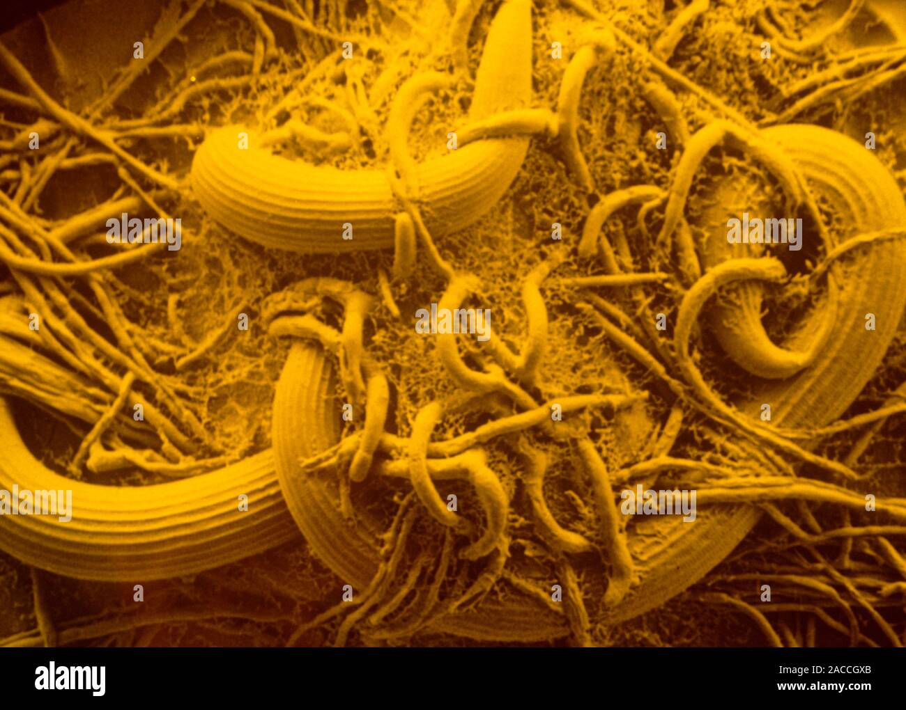 False-colour scanning electron micrograph of the predatory ...