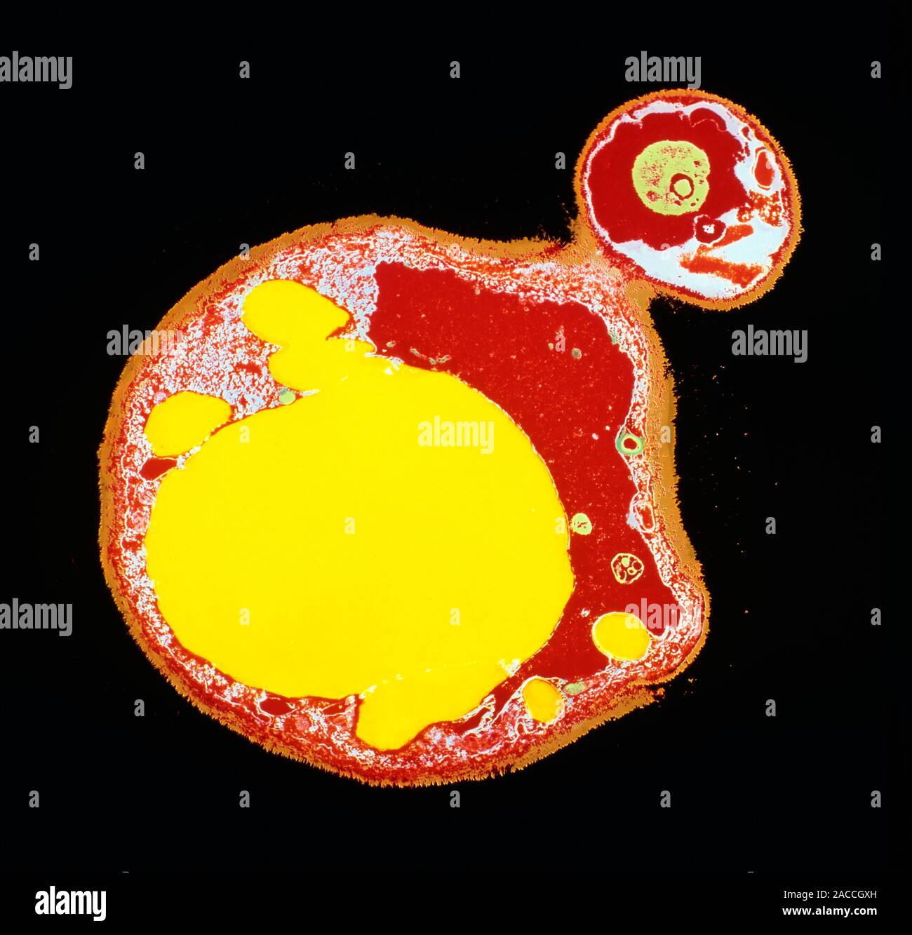False-colour transmission electron micrograph of a thin section of a ...