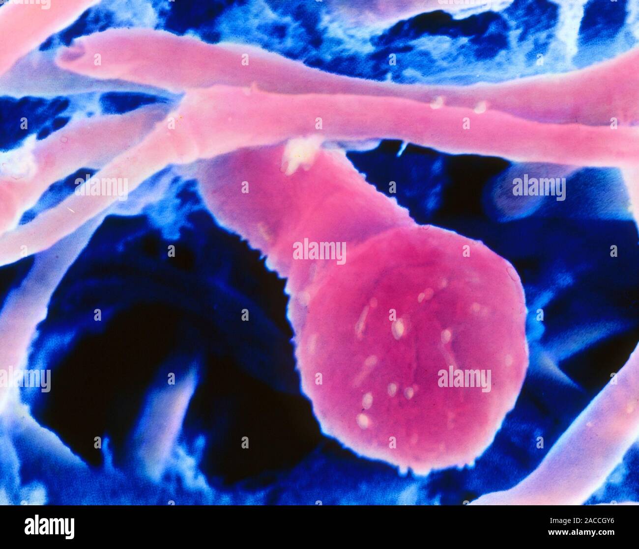 False-colour scanning electron micrograph (SEM) of the fungus ...