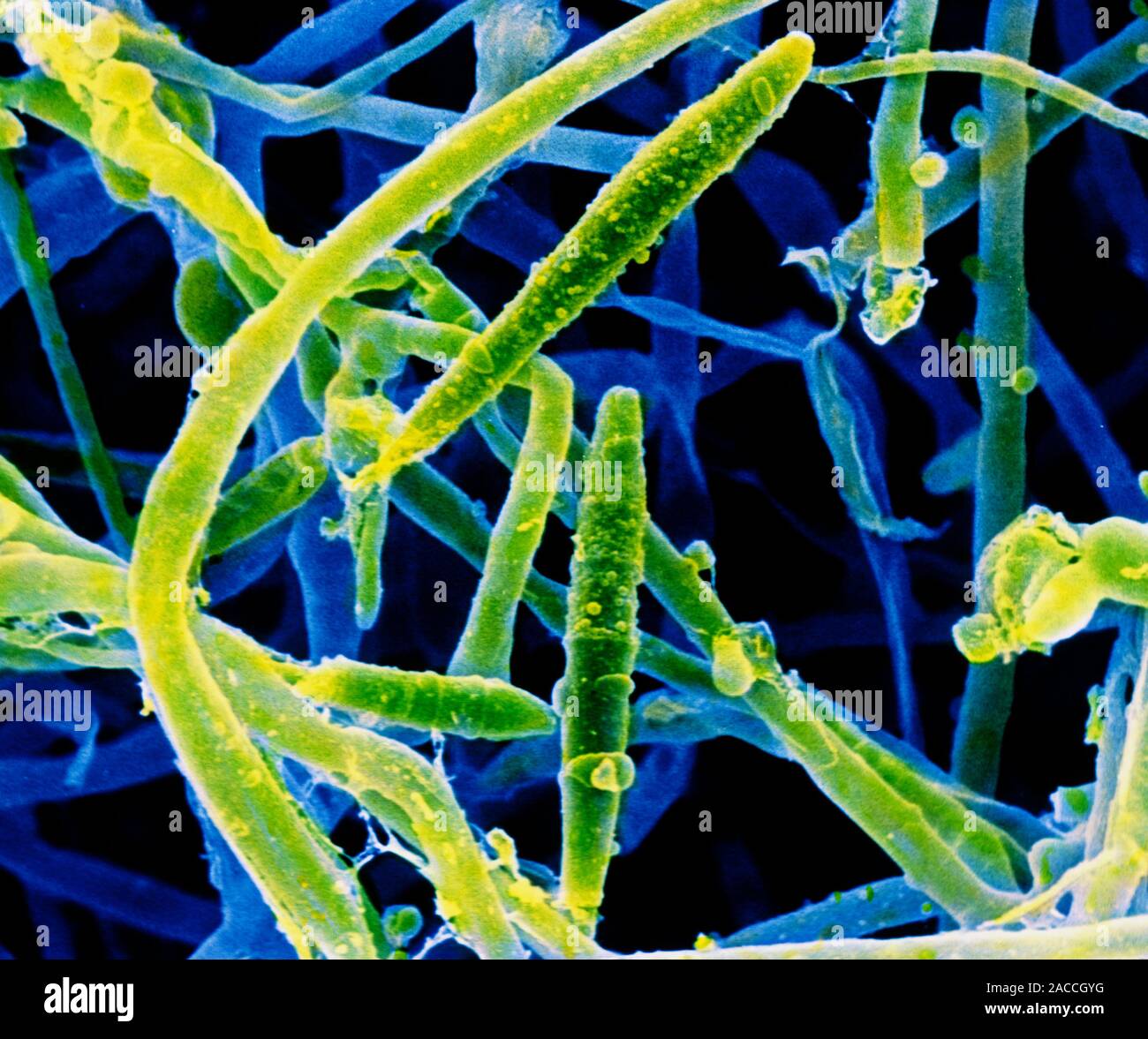 False-colour scanning electron micrograph (SEM) of the fungus ...