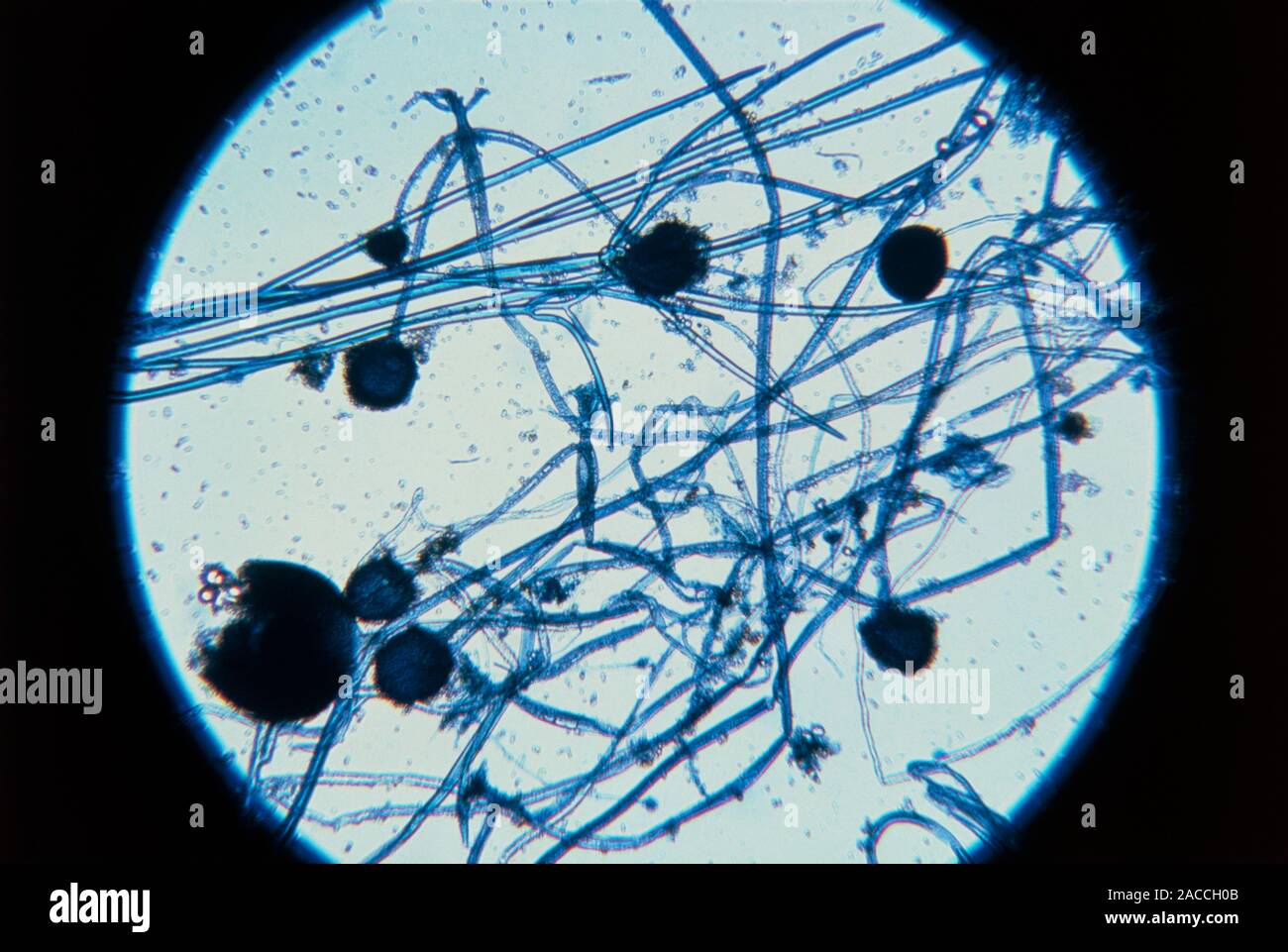 Bread mould. Light micrograph of the bread mould fungus, Rhizopus nigricans. Threads (hyphae) of ...