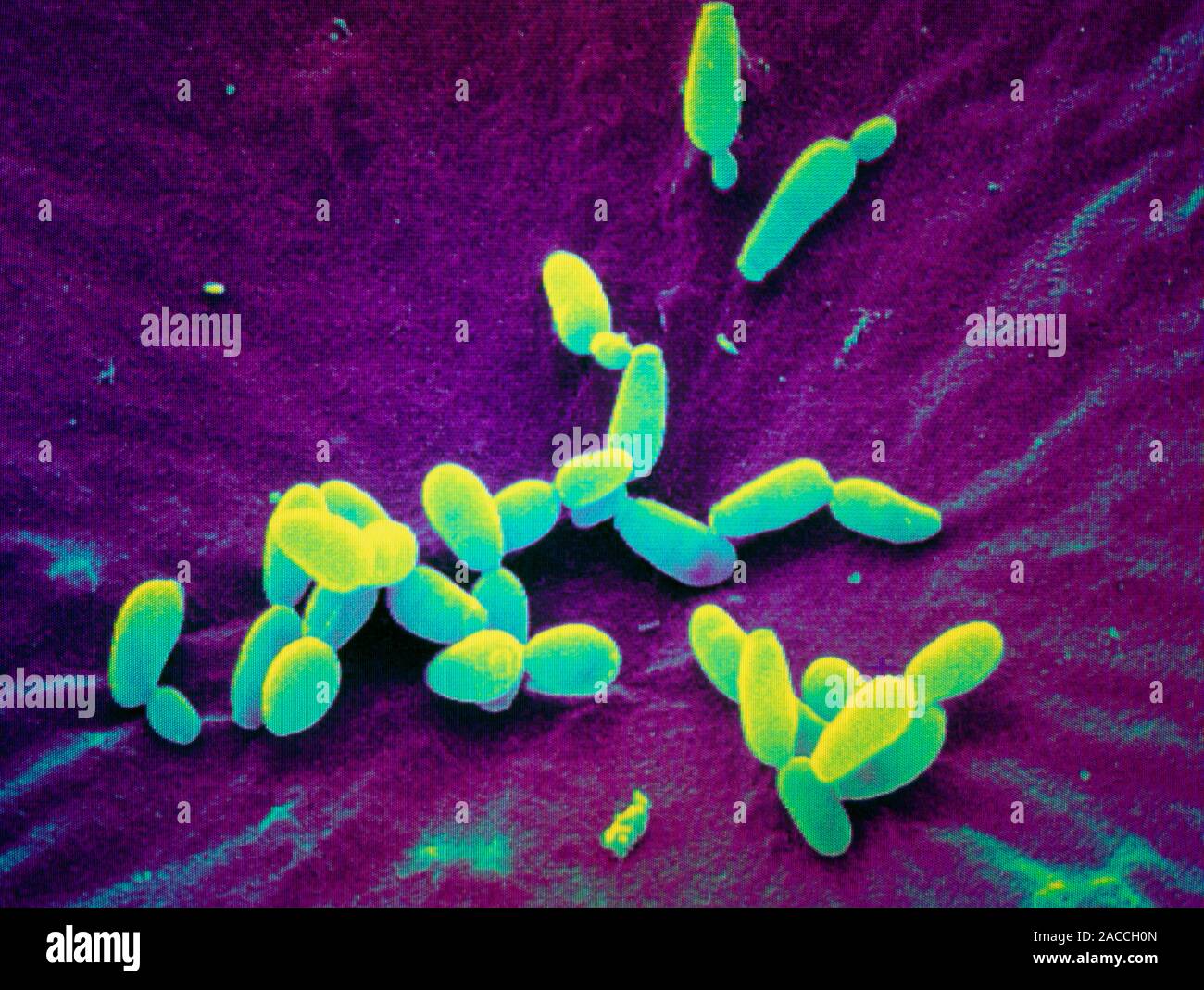 Yeast cells. Coloured scanning electron micrograph of baker's yeast ...