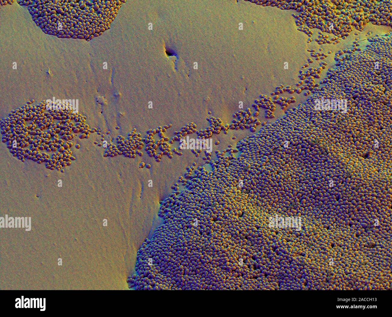 Yeast cells. Coloured Scanning Electron Micrograph (SEM) of yeast cells ...