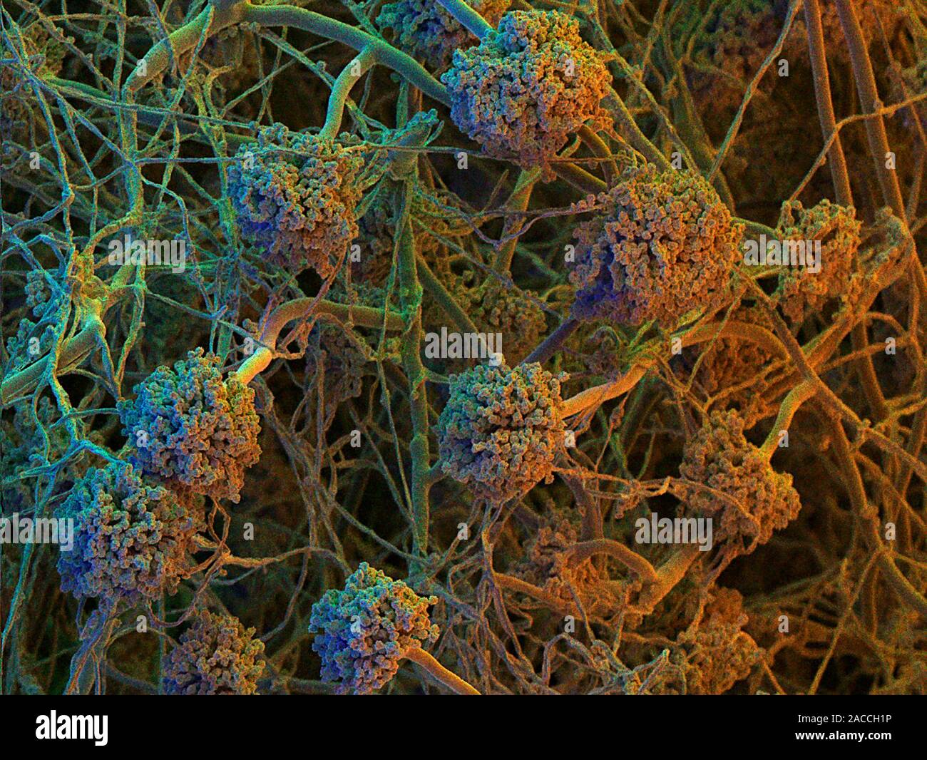 Aspergillus fumigatus. Coloured Scanning Electron Micrograph (SEM) of fruiting bodies of the ...