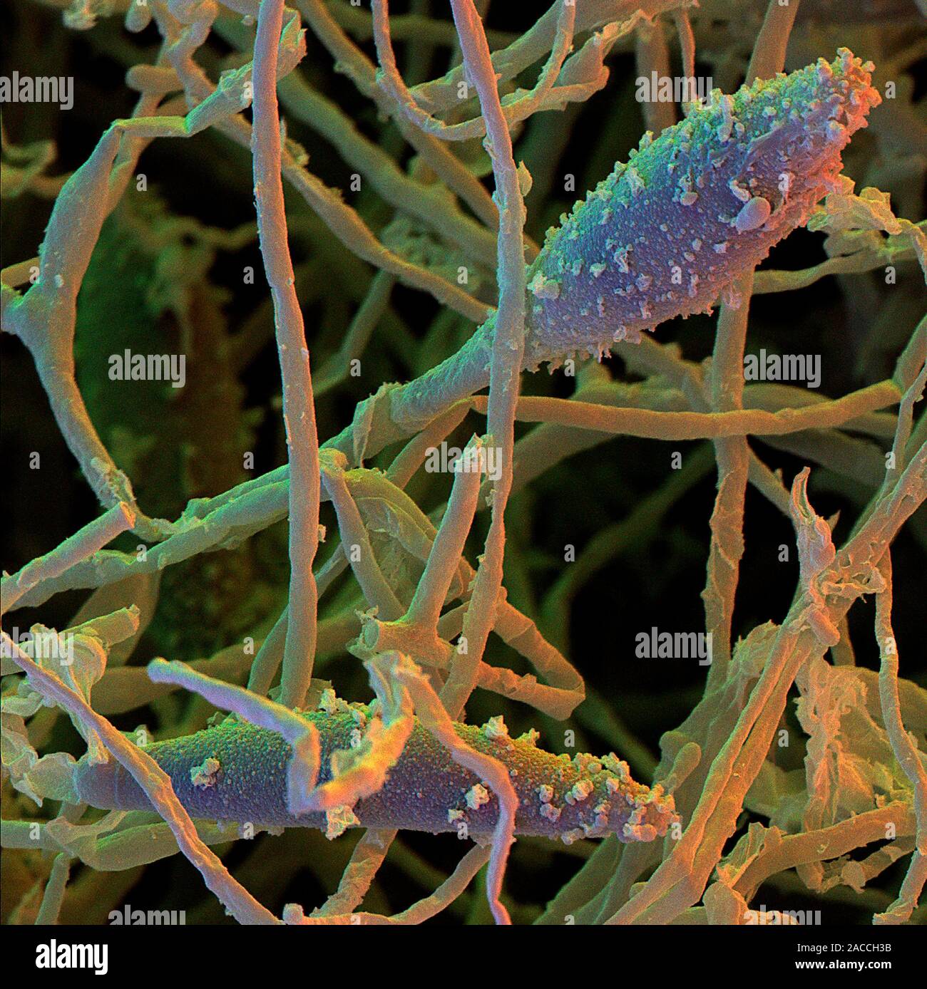 Microsporum canis. Coloured Scanning Electron Micrograph (SEM) of the ...