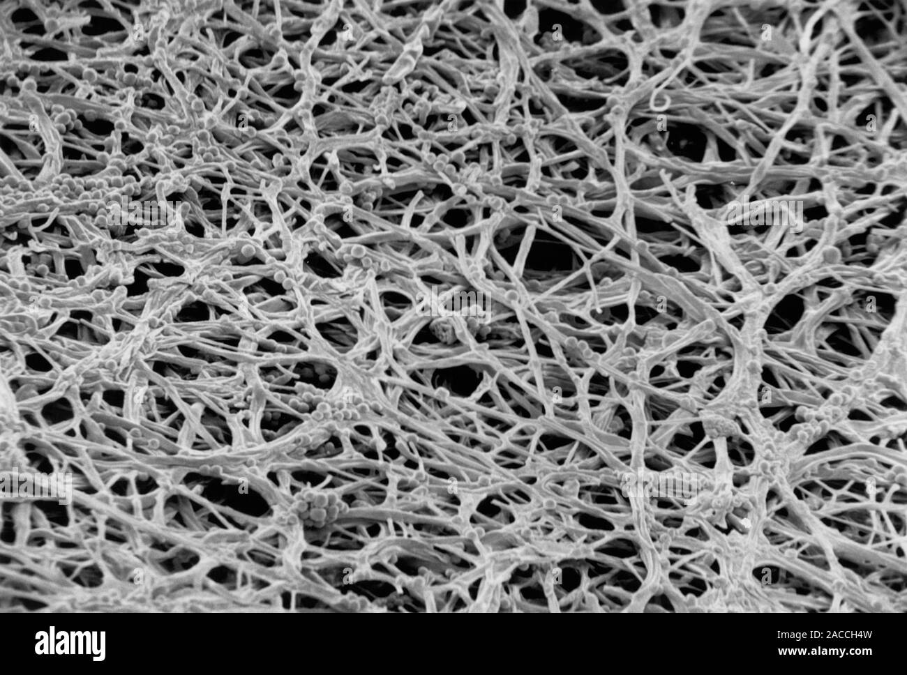 French Brie cheese mould. Scanning Electron Micro- graph (SEM) of the ...