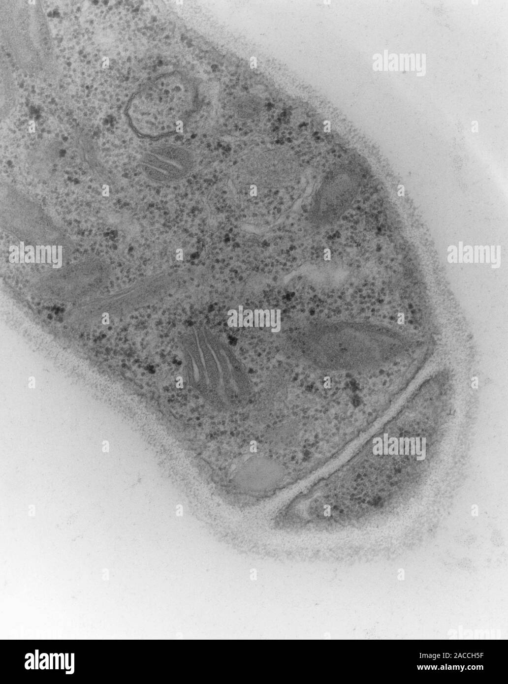 Trichoderma fungus. Transmission electron micrograph of a section ...