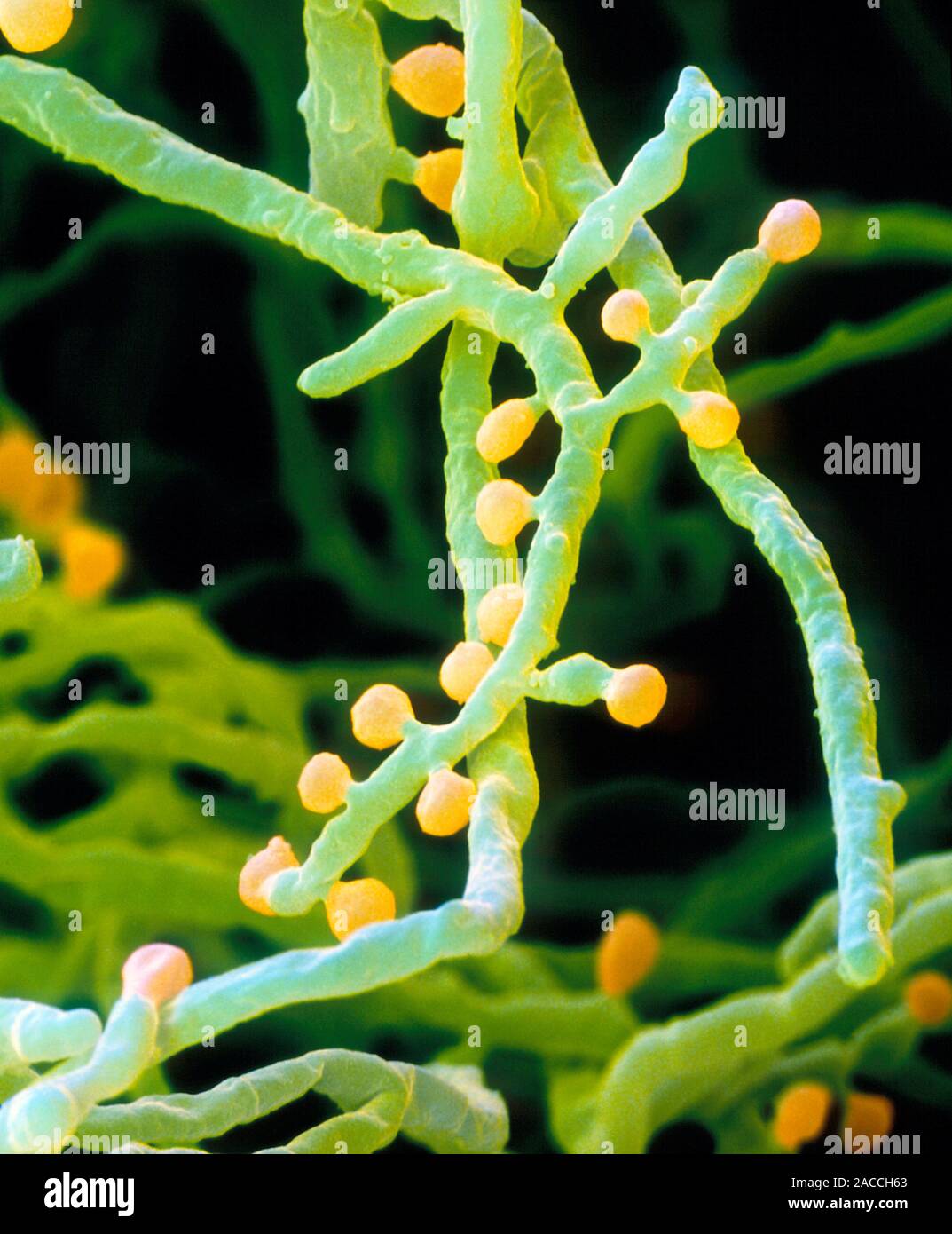 Trichophyton mentagrophytes. Scanning electron micrograph of the fungus ...