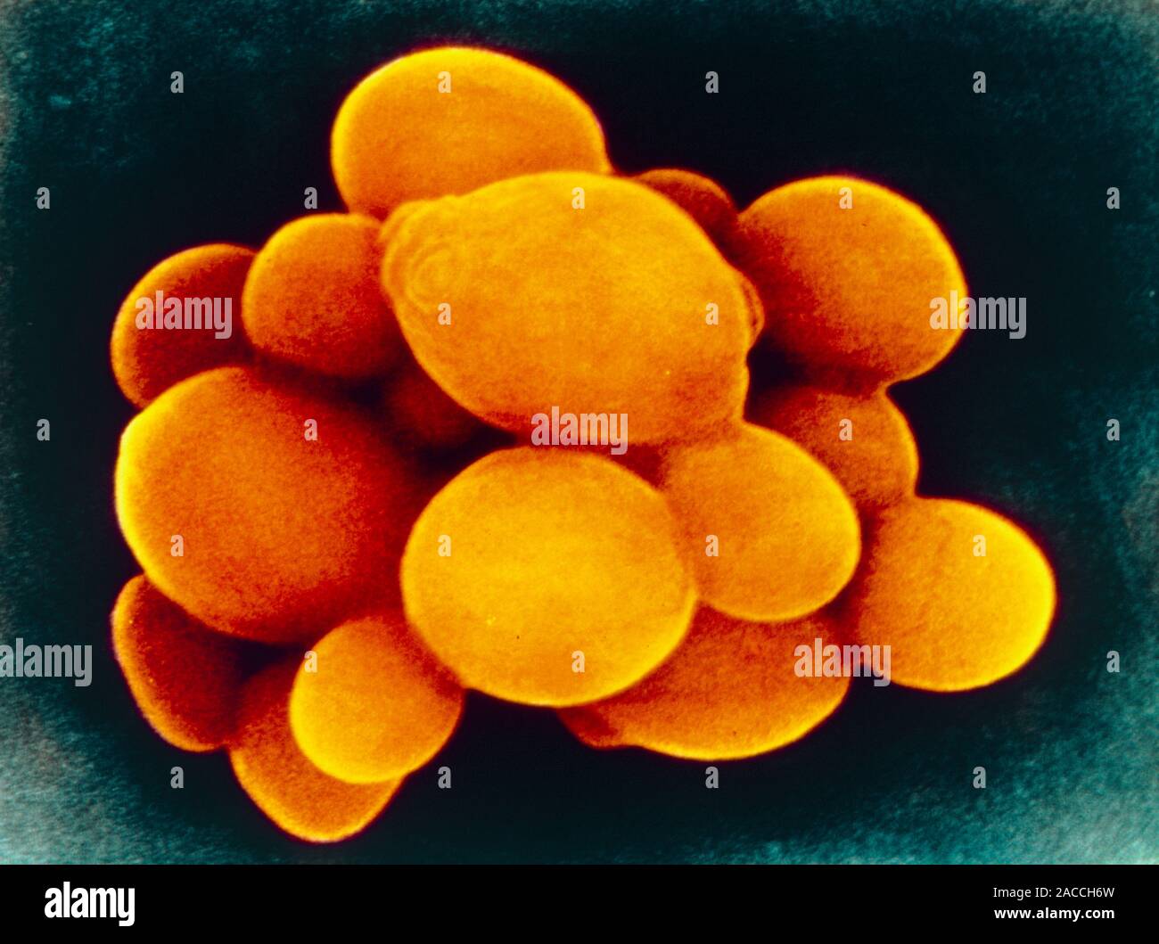 False-colour scanning electron micrograph (SEM) of Candida albicans, a ...