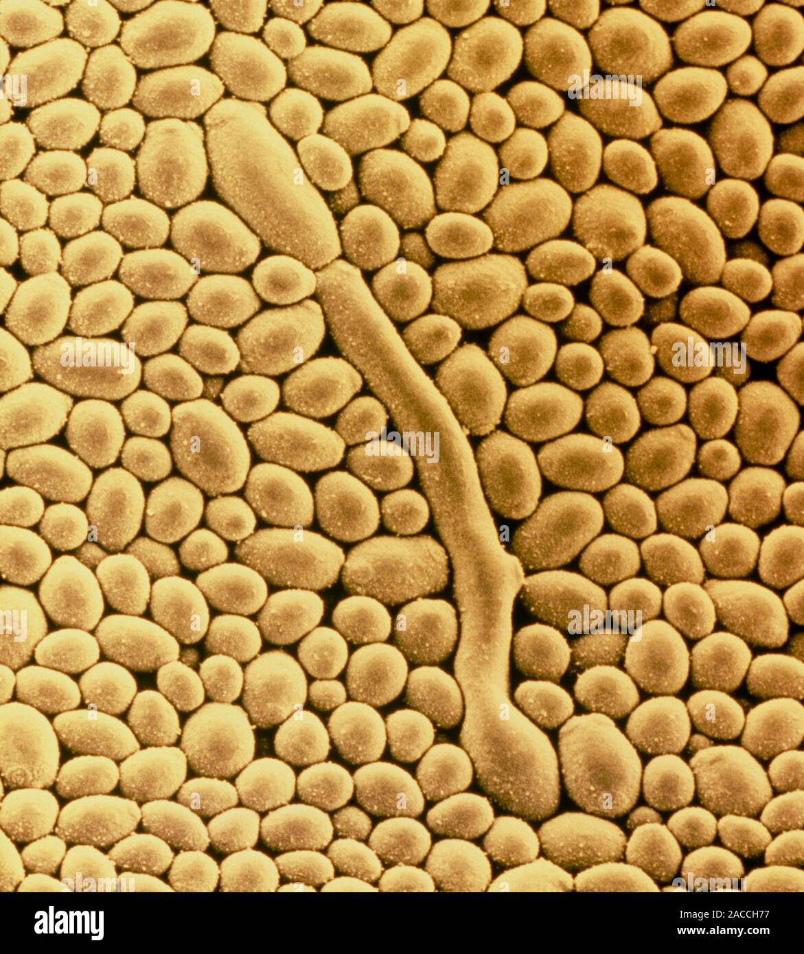 False-colour scanning electron micrograph of yeast cells of the fungus ...