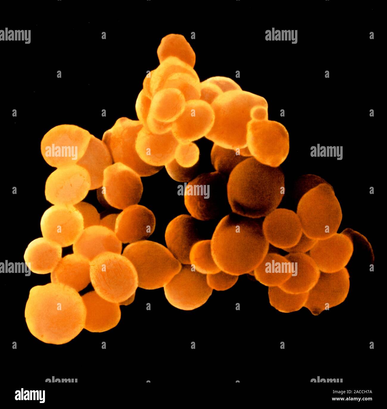 Coloured scanning electron micrograph (SEM) of Candida albicans, a ...