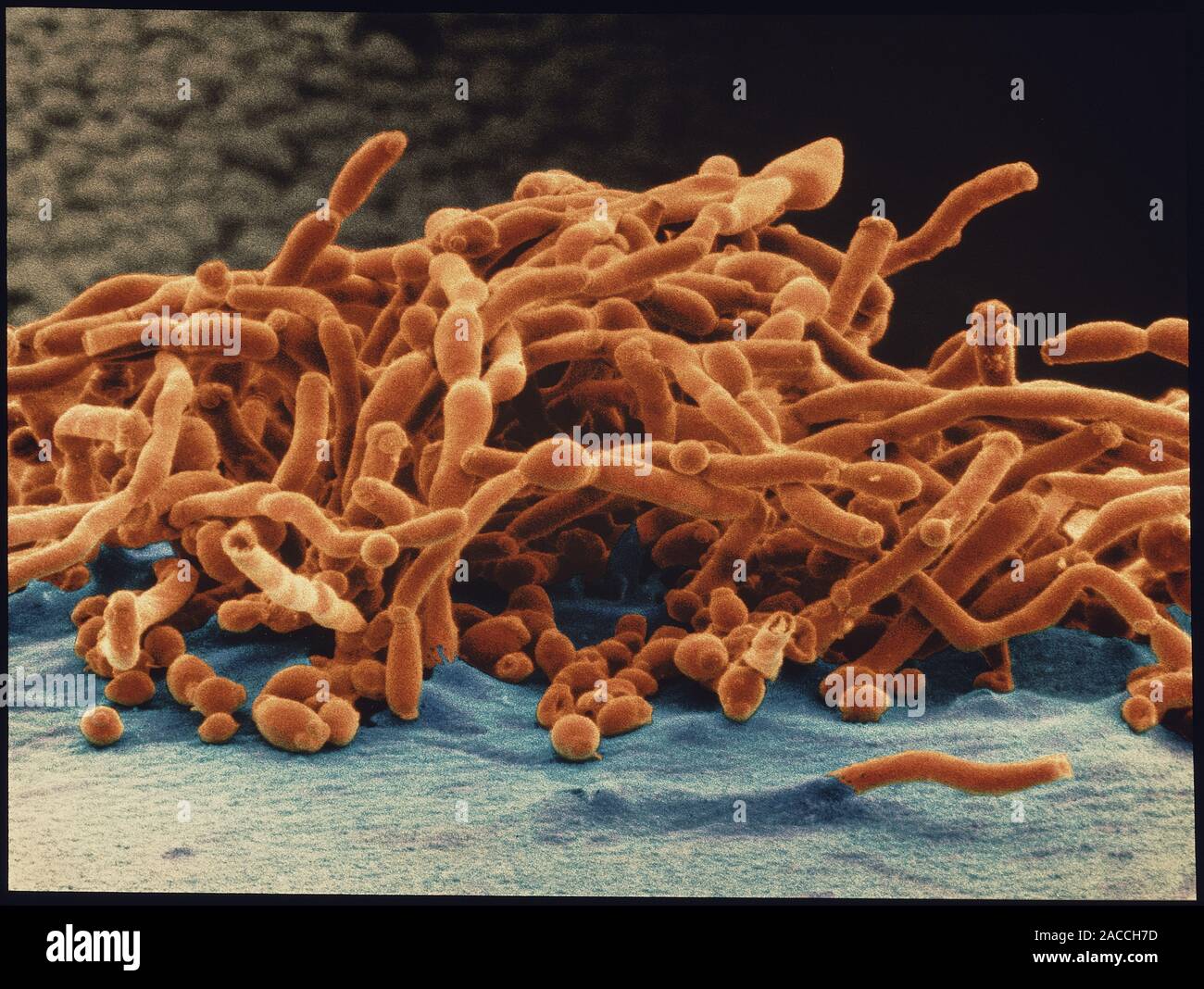 Candida albicans. Coloured Scanning Electron Micrograph (SEM) of the ...