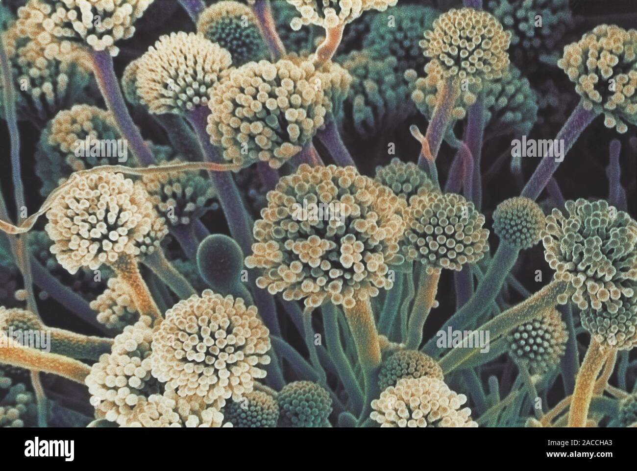Aspergillus fungus. Coloured scanning electron micrograph (SEM) of the fungus Aspergillus sp ...