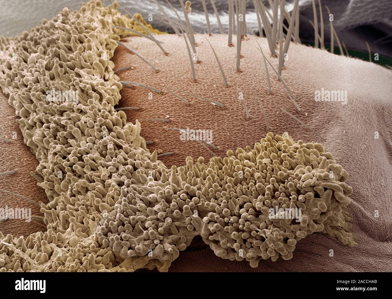 Fungus on fly. Coloured scanning electron micrograph (SEM) of an ...