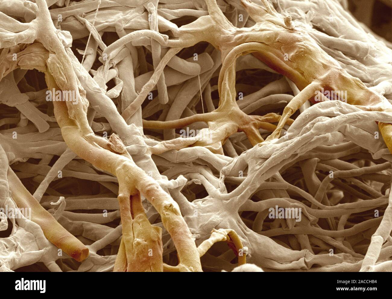 Brie cheese mould. Coloured scanning electron micrograph (SEM) of the ...