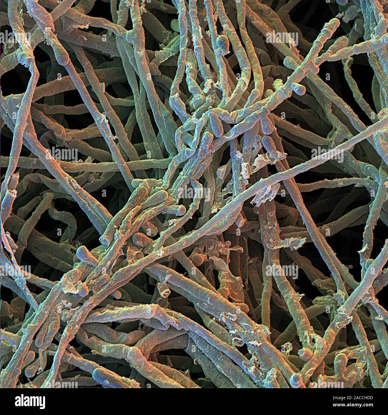 Skin fungus. Coloured scanning electron micrograph (SEM) of the ...