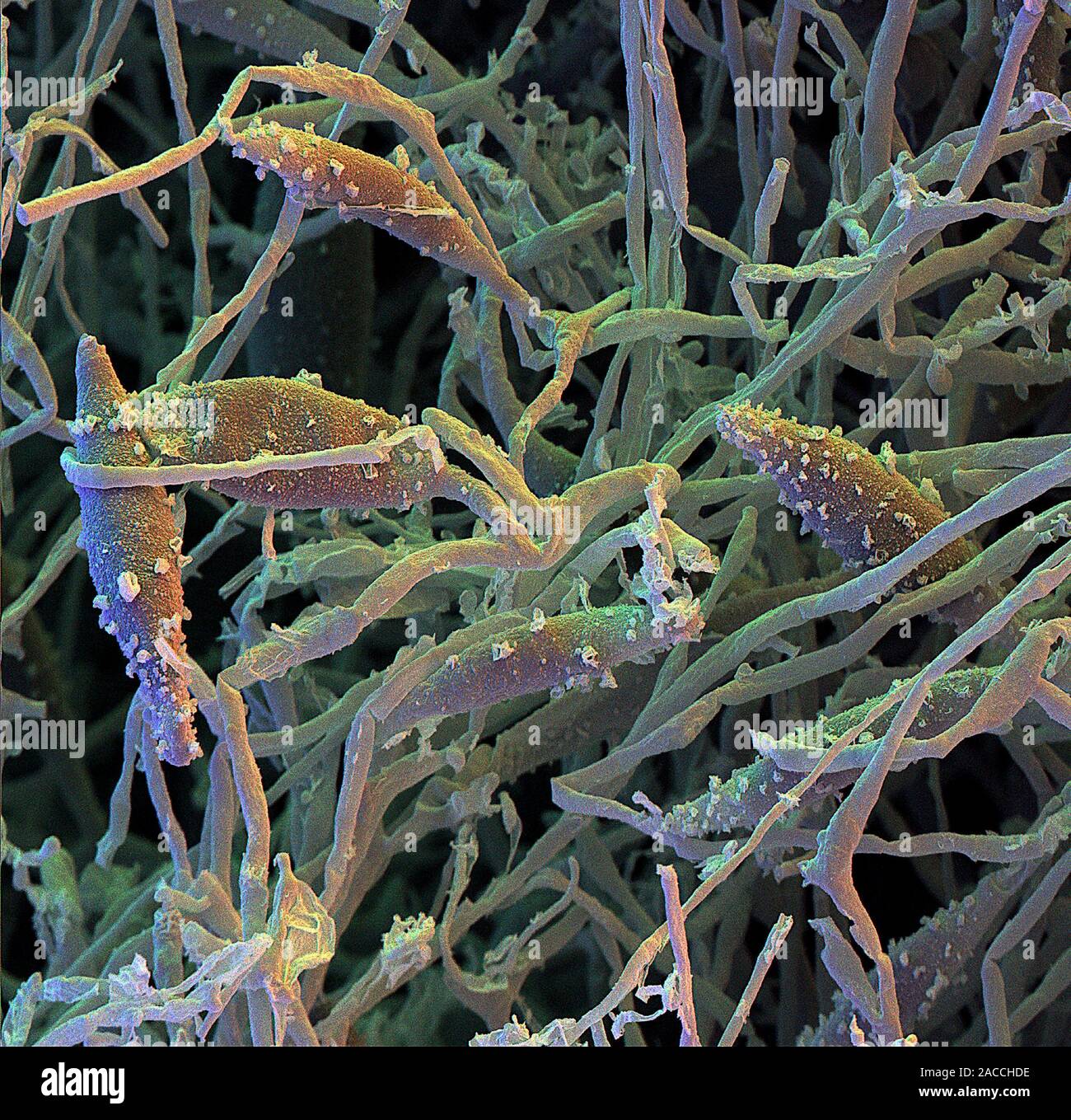 Skin fungus. Coloured scanning electron micrograph (SEM) of the ...