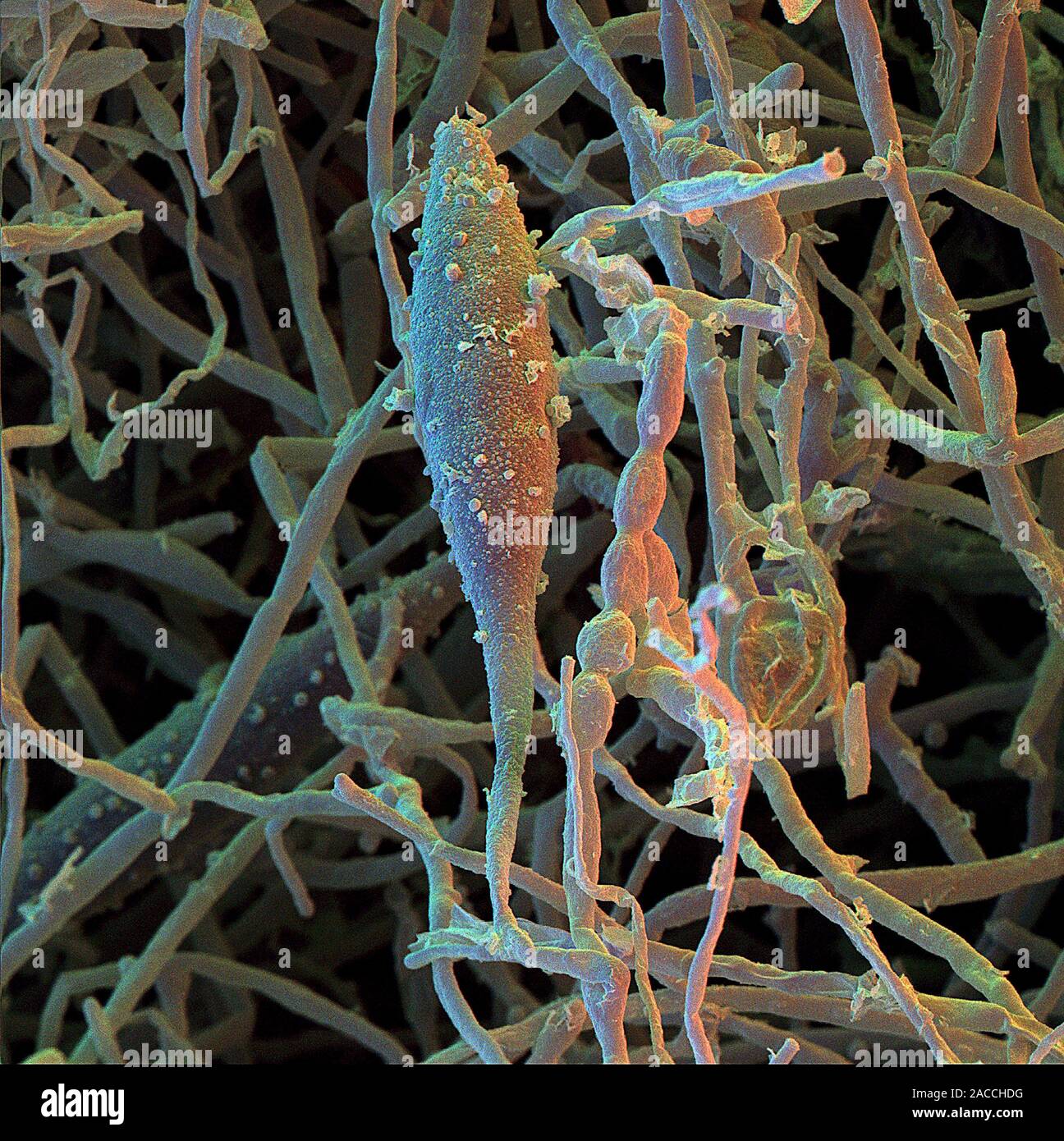 Skin fungus. Coloured scanning electron micrograph (SEM) of the ...