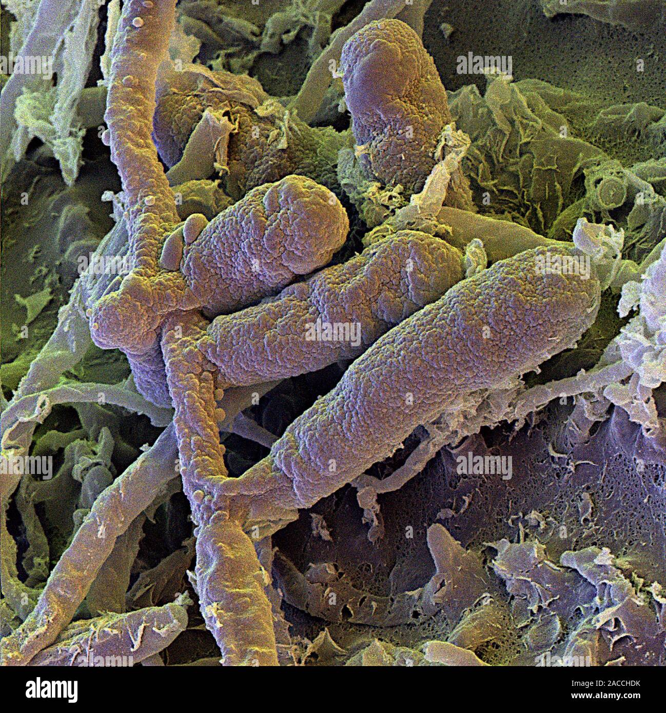 Skin fungus. Coloured scanning electron micrograph (SEM) of the ...