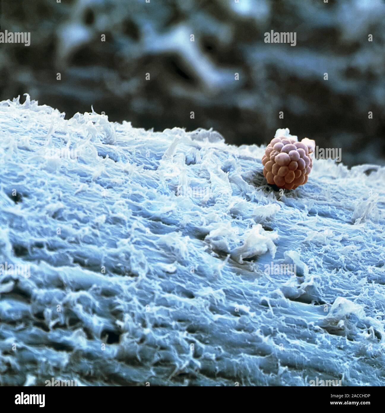 Yeast. Coloured scanning electron micrograph (SEM) of yeast cells ...
