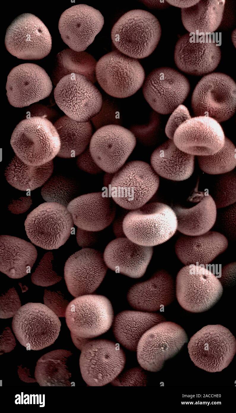 Fungal spores. Coloured scanning electron micrograph (SEM) of the ...