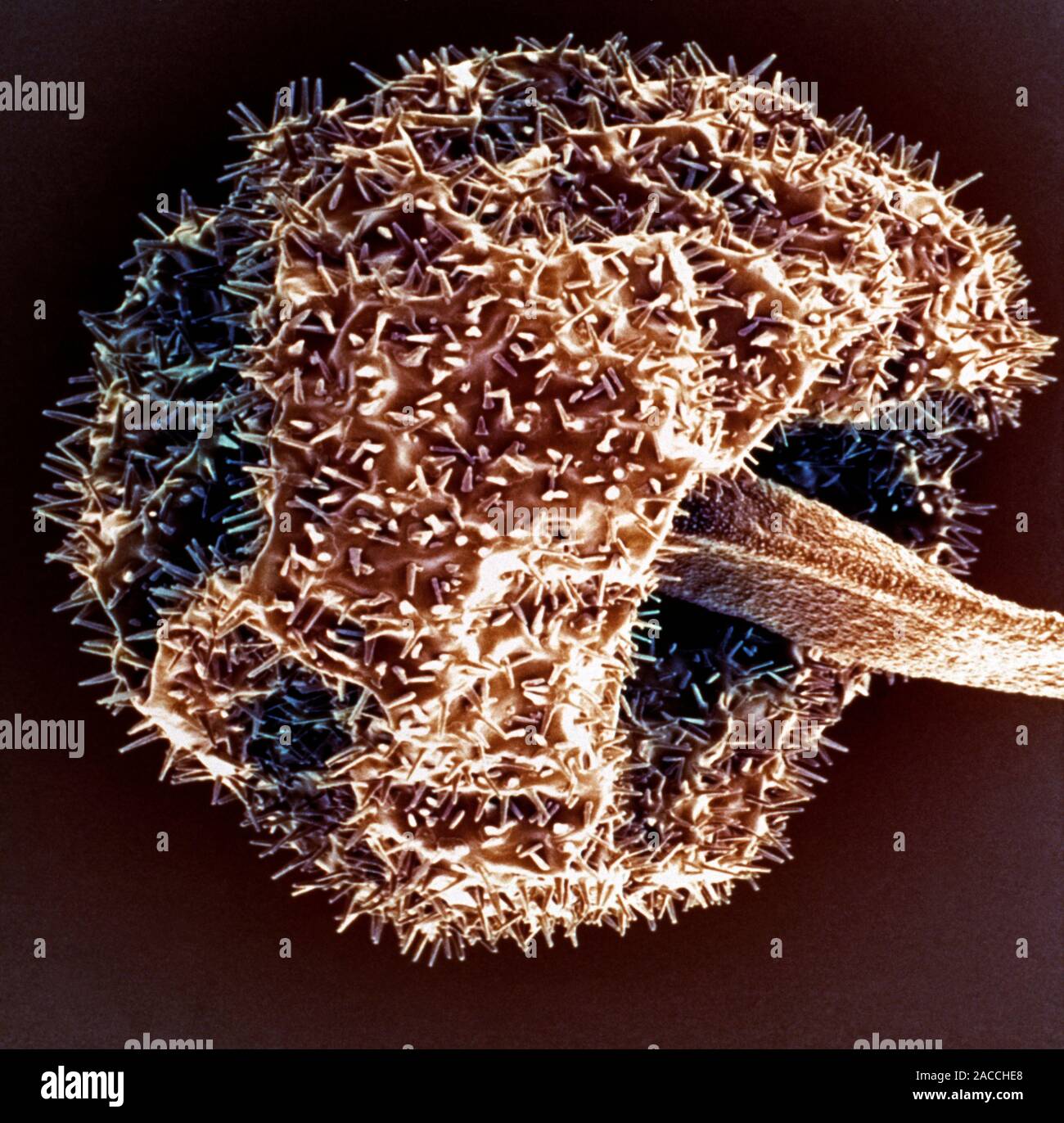 Fungal sporangium. Coloured scanning electron micrograph (SEM) of the ...
