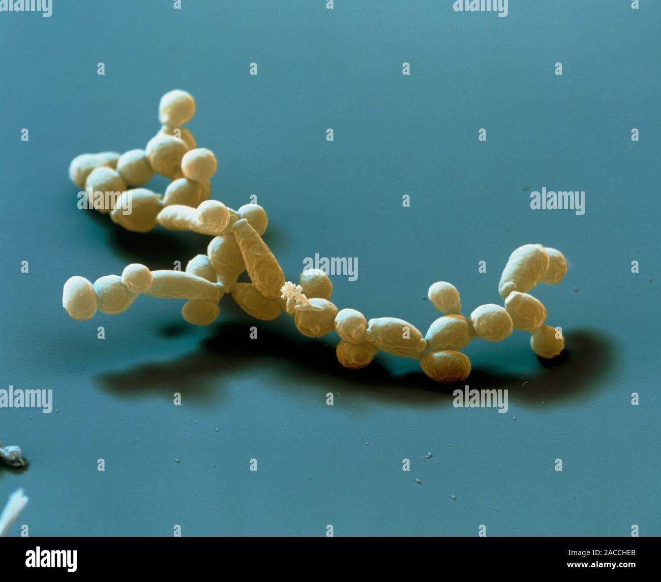 Candida albicans fungus. Coloured scanning electron micrograph (SEM) of ...