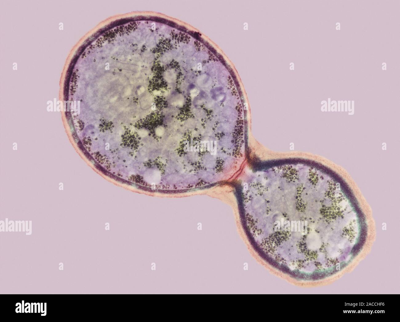 Cryptococcus cell dividing. Coloured transmission electron micrograph ...