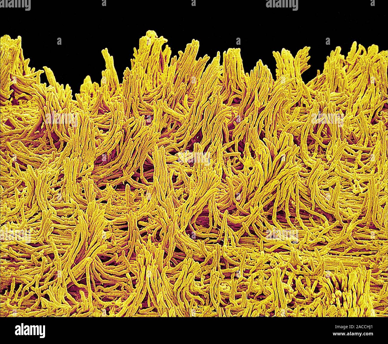 Mushroom stem. Coloured scanning electron micrograph (SEM) of the ...