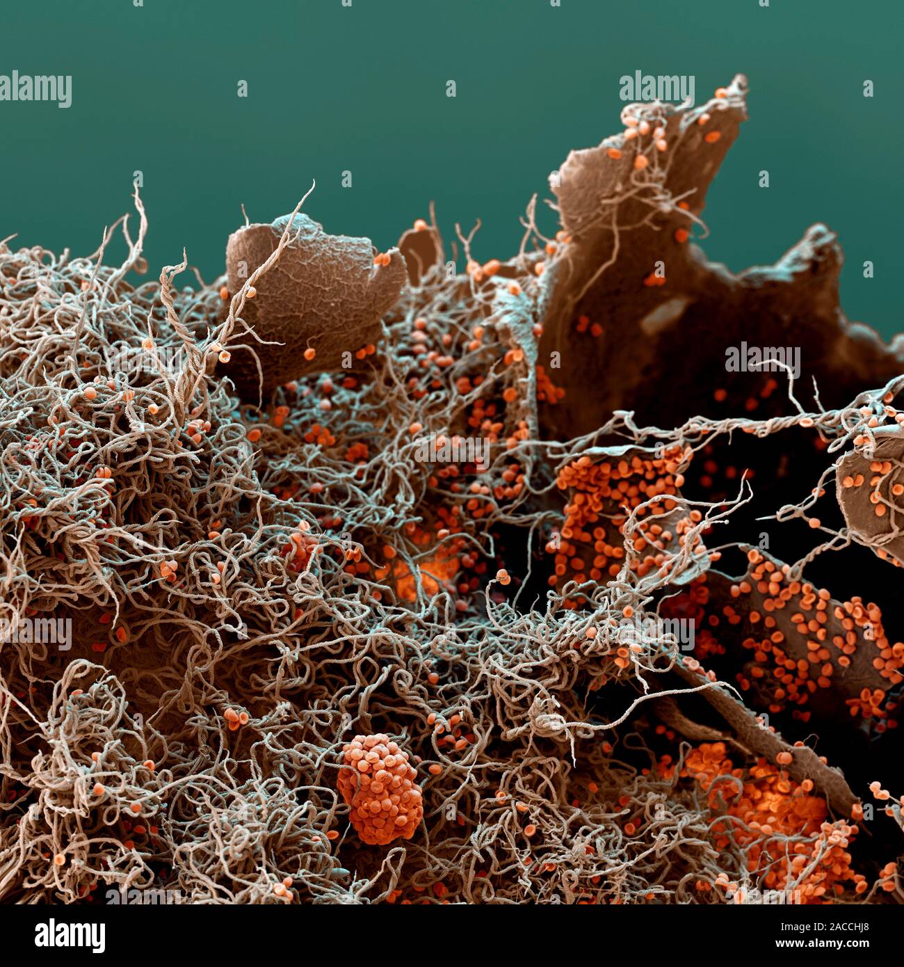 Slime mould spores. Coloured scanning electron micrograph (SEM) of the ...