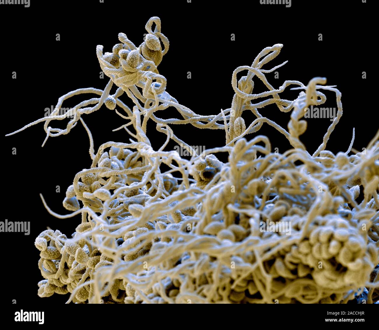 Slime mould spores. Coloured scanning electron micrograph (SEM) of ...