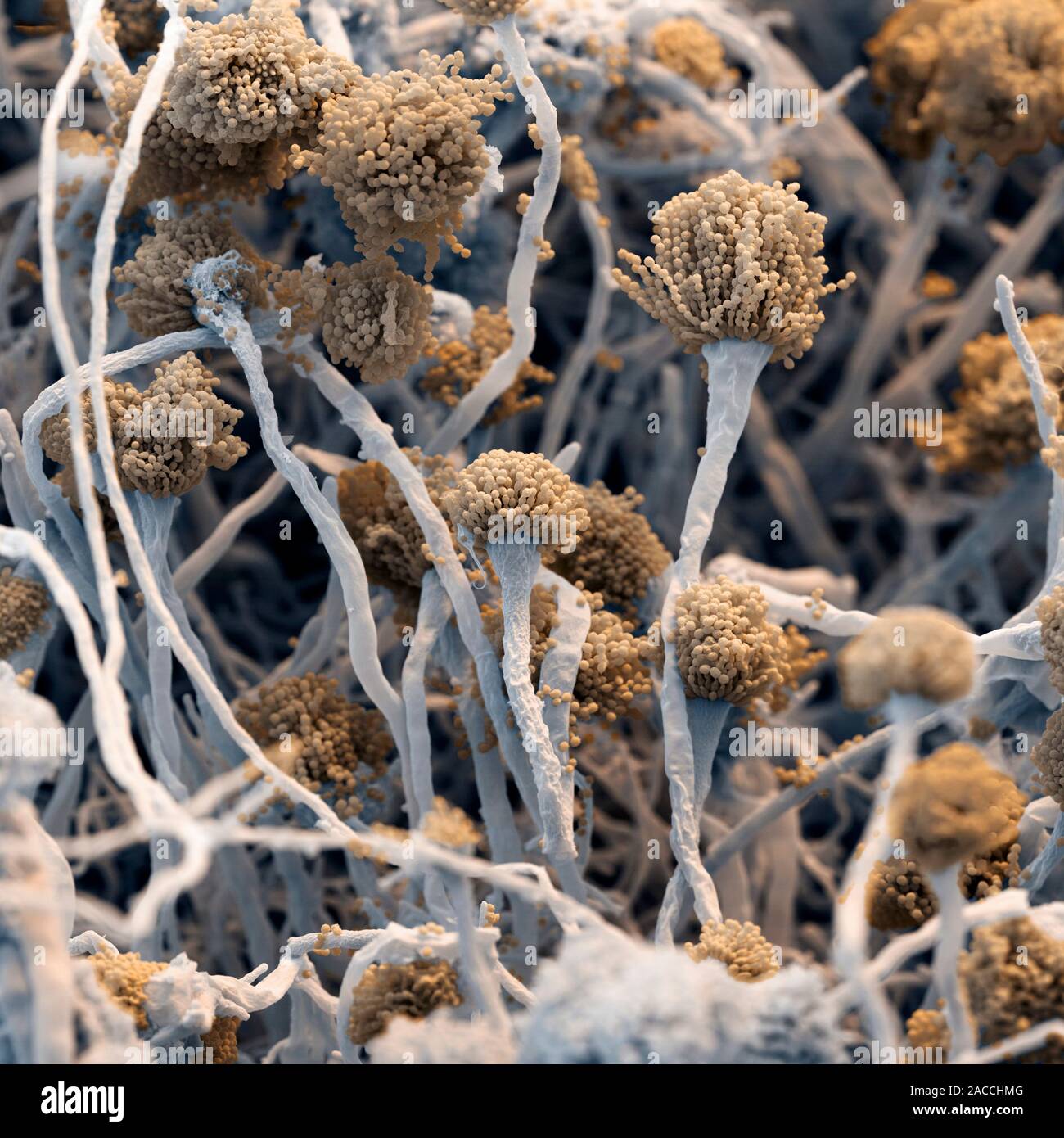 Aspergillus fungus. Coloured scanning electron micrograph (SEM) of the fungus Aspergillus ...