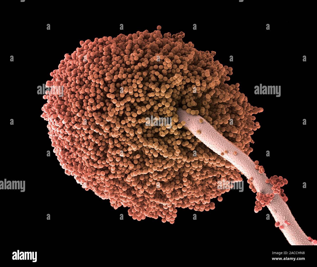 Fungal spores. Coloured scanning electron micrograph (SEM) of fungal spores on a fruiting body ...