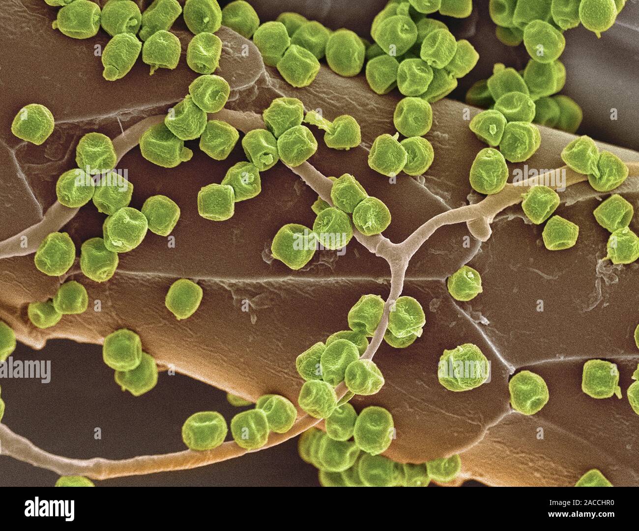 Fungal spores. Coloured scanning electron micrograph (SEM) of the ...