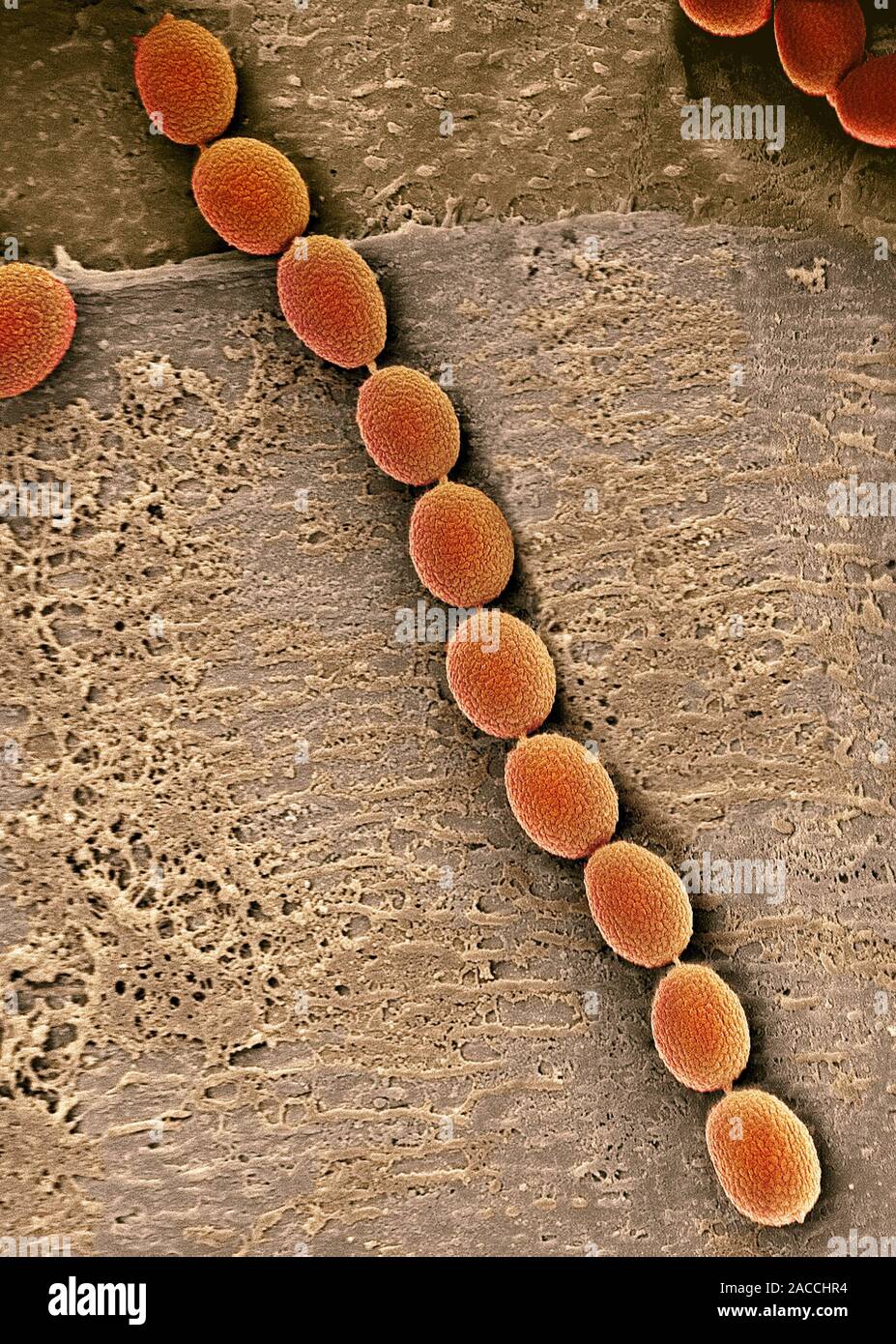 Fungal spores. Coloured scanning electron micrograph (SEM) of the ...