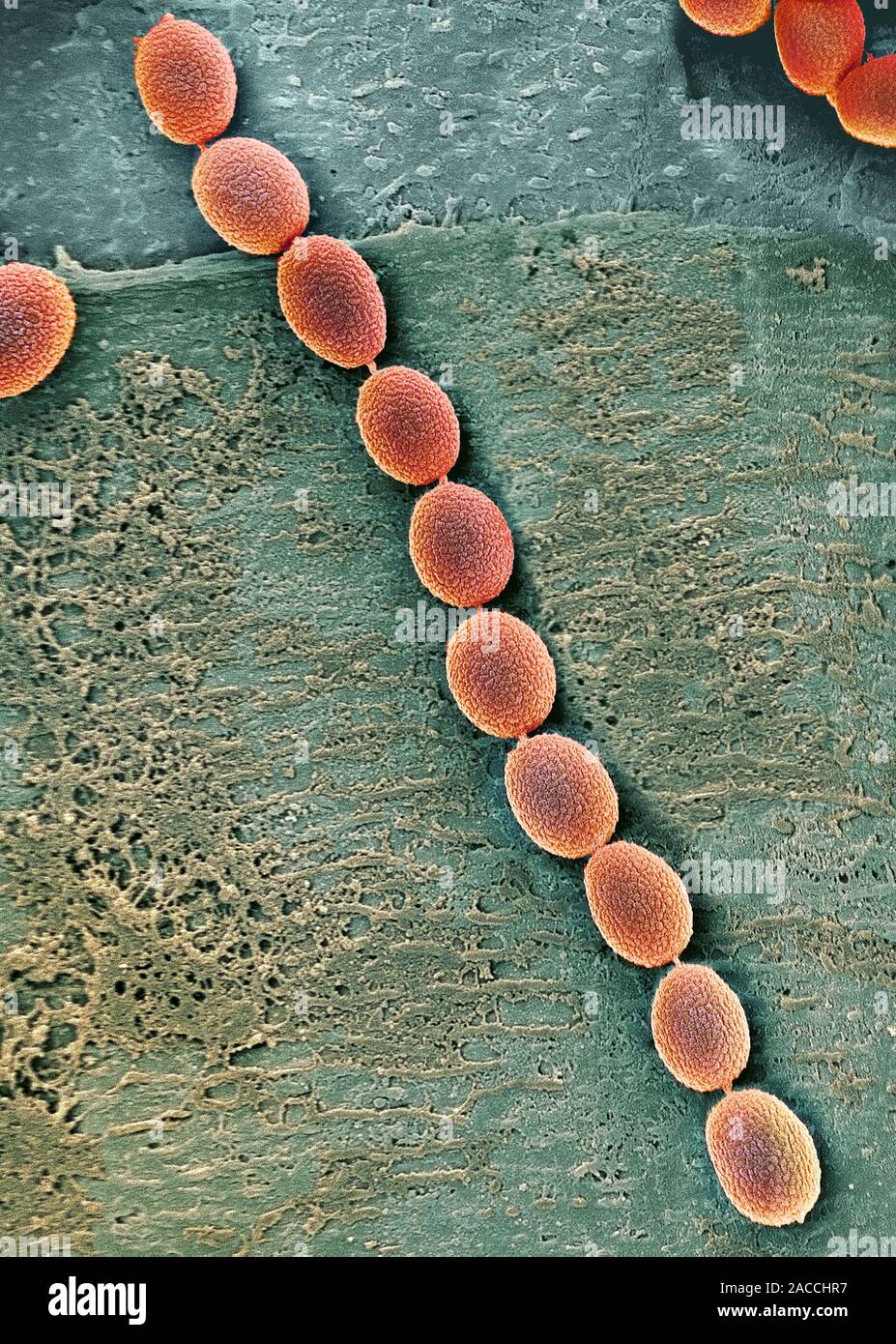 Fungal spores. Coloured scanning electron micrograph (SEM) of the ...
