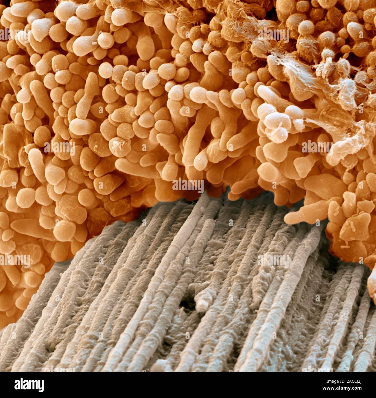 Ergot fungus. Coloured scanning electron micrograph (SEM) of the fungus ...