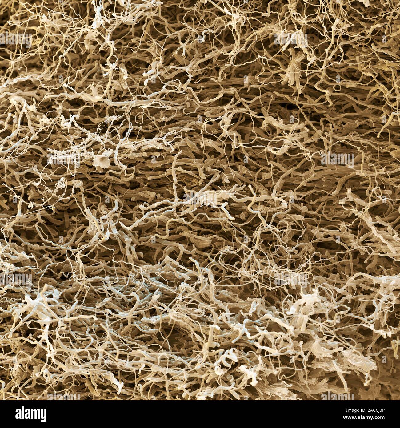 Fungal mycelium. Coloured scanning electron micrograph (SEM) of fungal ...