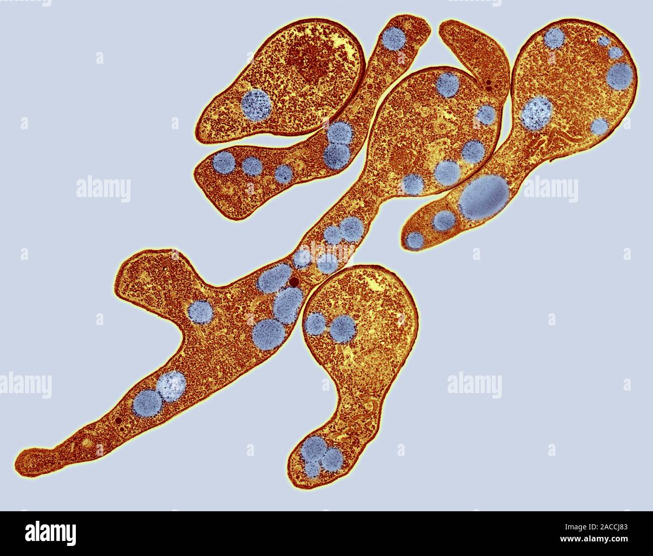 Germinating fungal spores. Coloured transmission electron micrograph ...