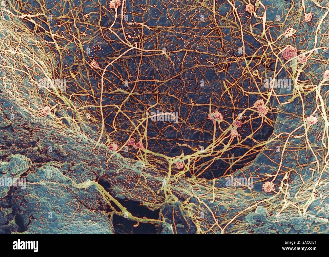 Bread mould. Coloured scanning electron micrograph (SEM) of fungal ...