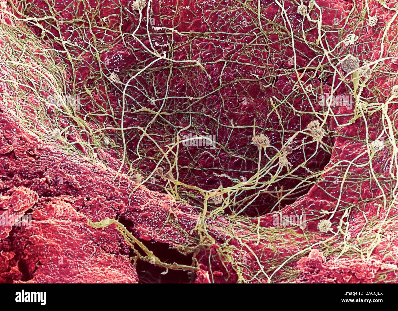 Bread mould. Coloured scanning electron micrograph (SEM) of fungal ...