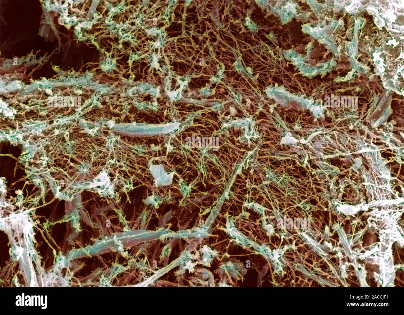 Dry rot fungus. Coloured scanning electron micrograph (SEM) of dry rot ...