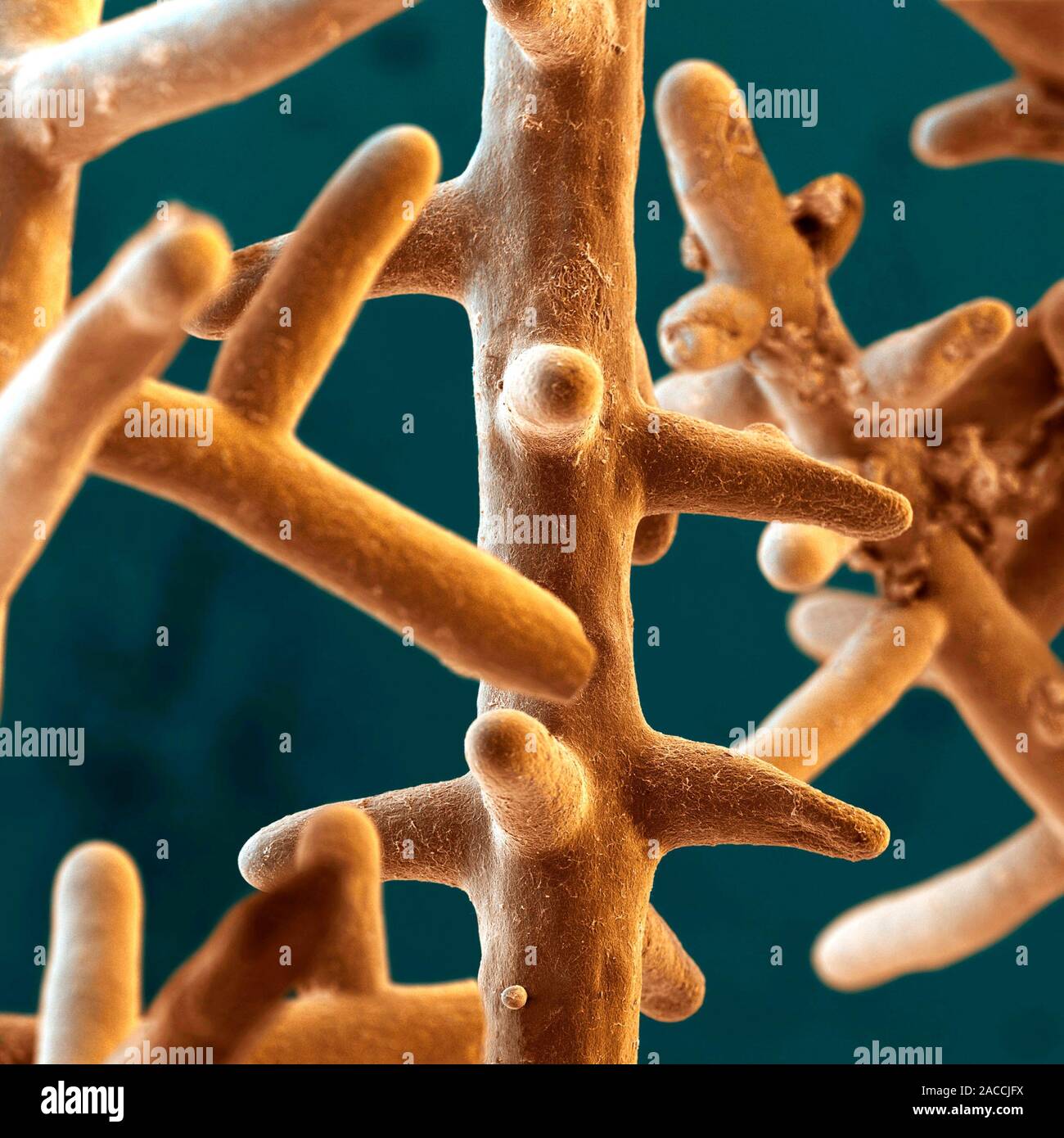 Mycorrhiza, coloured scanning electron micrograph (SEM). A mycorrhiza ...