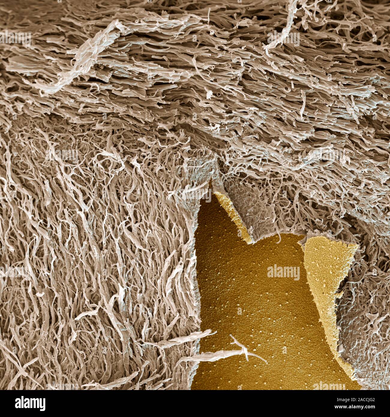 Late fall oyster mushroom. Coloured scanning electron micrograph (SEM ...