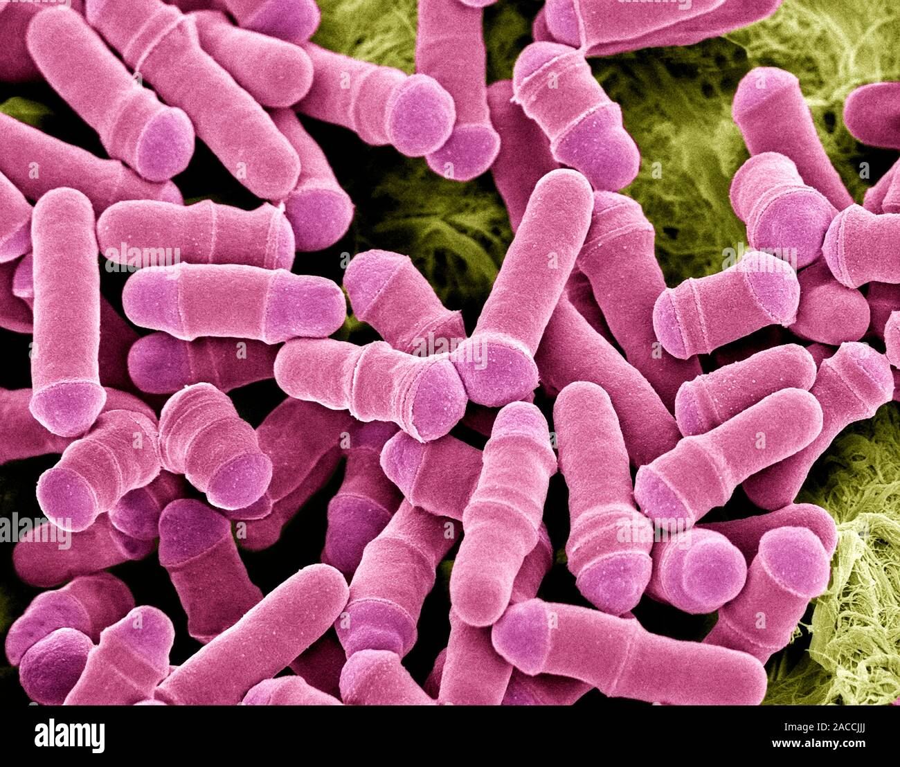 Dividing yeast cells. Coloured scanning electron micrograph (SEM) of ... Dividing yeast cells. Coloured scanning electron micrograph (SEM) of ...