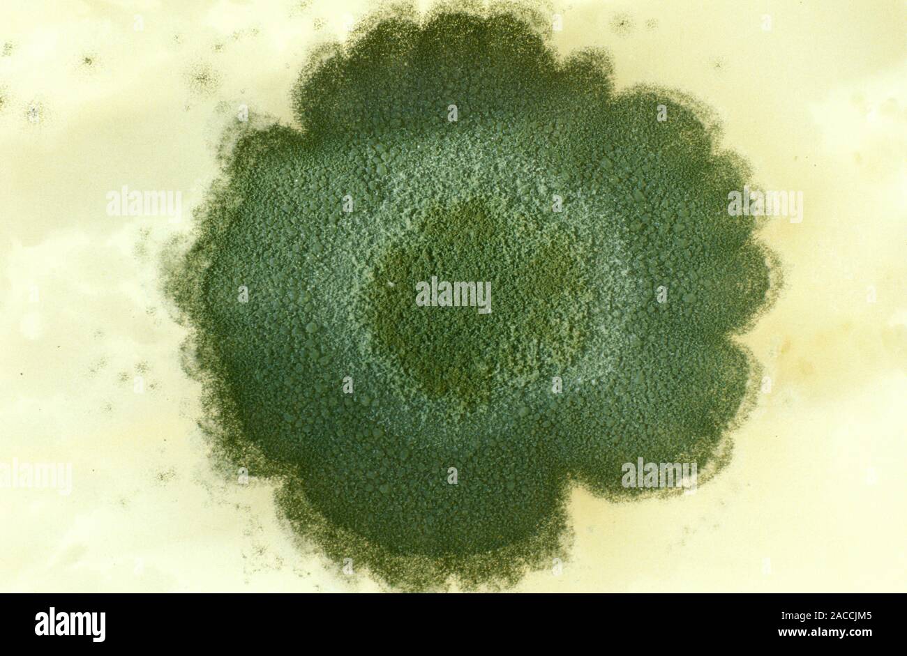 Penicillium Notatum 40x