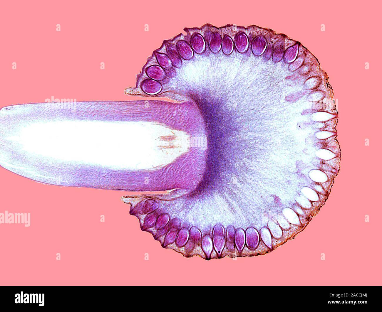 Ergot fungus. Light micrograph of a vertical section of the fruiting ...